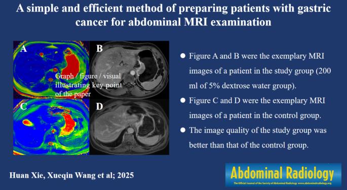 A simple and efficient method of preparing patients with gastric cancer ...