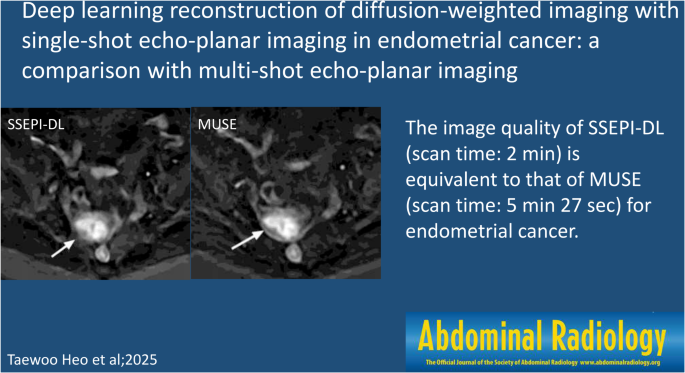 Deep learning reconstruction of diffusion-weighted imaging with single ...