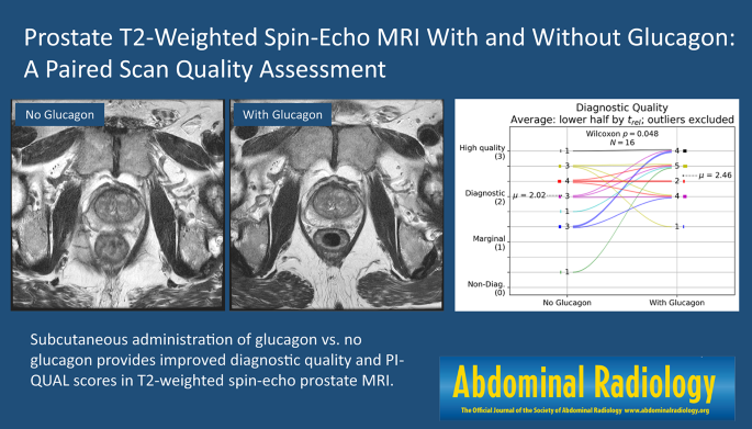 Prostate T2-weighted spin-echo MRI with and without glucagon: a paired ...