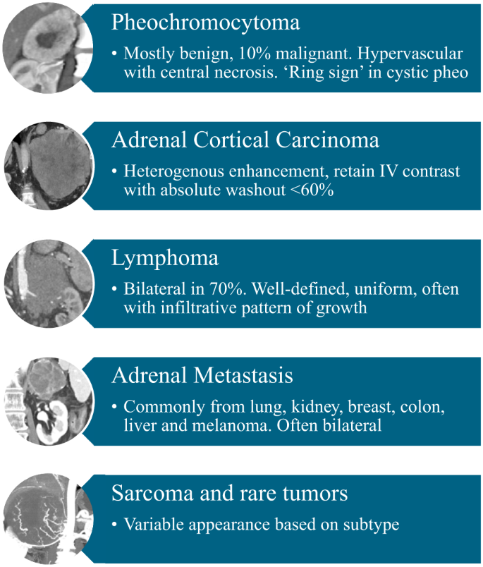 A comprehensive approach to the CT detection and evaluation of large ...