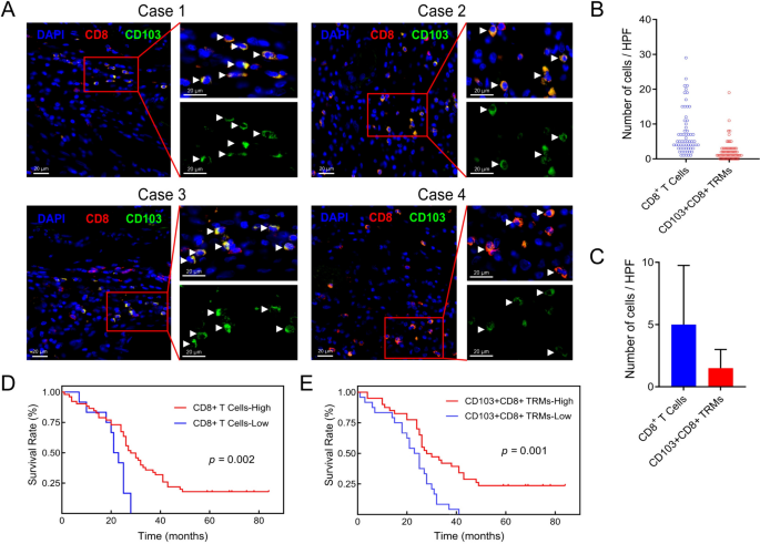 Tissue-resident memory CD103+CD8+ T cells in colorectal cancer: its ...