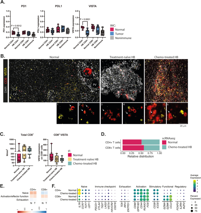 High-plex imaging of hepatoblastoma and adjacent liver in pediatric ...