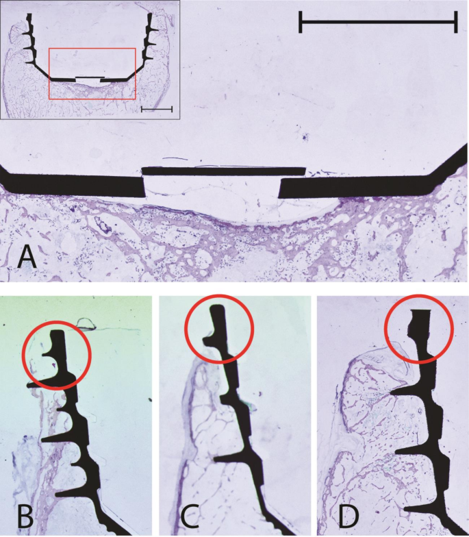 Osseointegration of threaded acetabular cups - radiological and ...