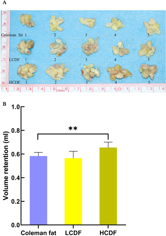 Concentrated Deoiled Fat: A Novel Method of Fat Processing to Improve ...