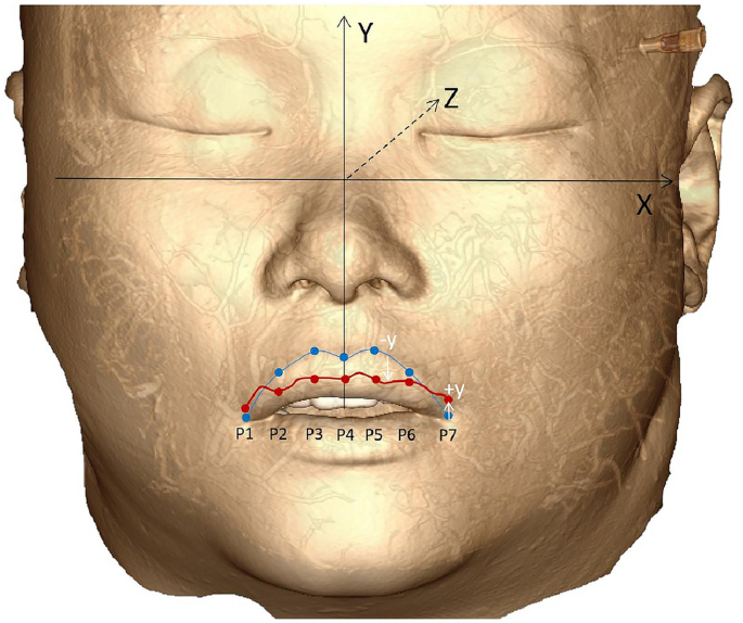 Three-Dimensional Computed Tomography Scanning Study of the Superior ...