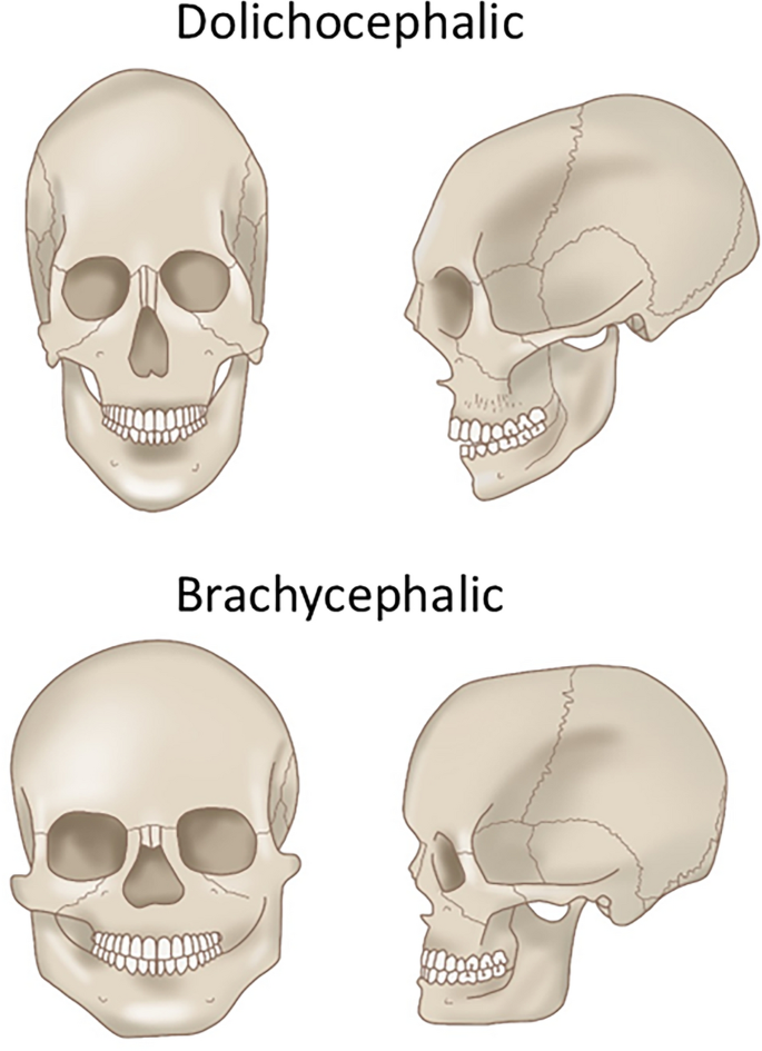 Injectable Hyaluronic Acid Filler for Increasing Head Circumference and ...