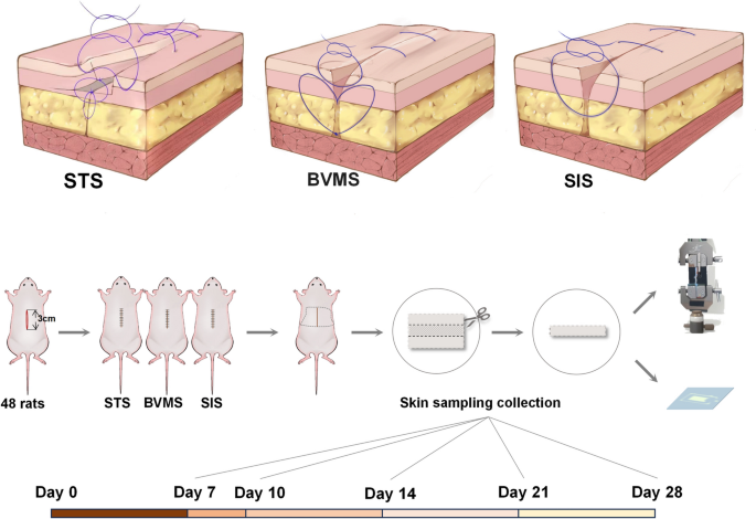 The Split-Level Folding, Step-Type Tension-Relieving Suture Technique ...