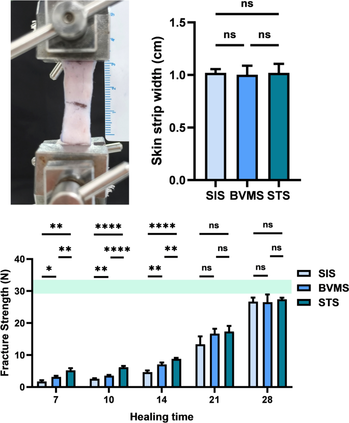 The Split-Level Folding, Step-Type Tension-Relieving Suture Technique ...