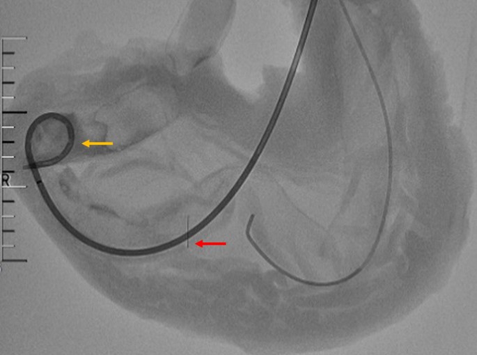 An Ex Vivo Animal Organ Model Tailored for Fluoroscopically Guided ...