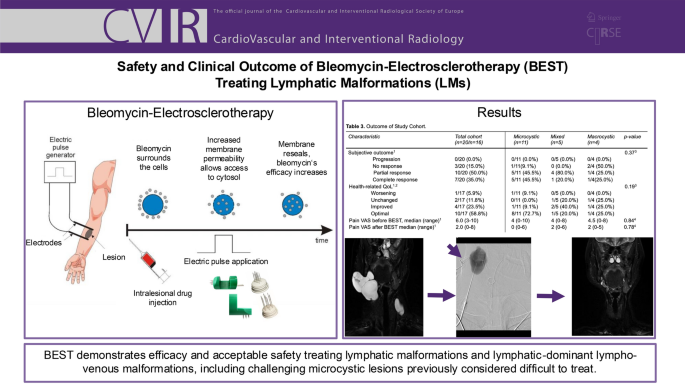 Safety and Clinical Outcome of Bleomycin-Electrosclerotherapy (BEST ...