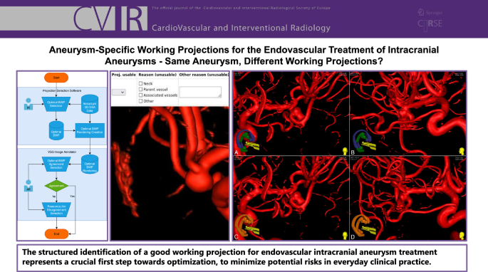 Aneurysm Specific Working Projections for the Endovascular Treatment of Intracranial Aneurysms ...