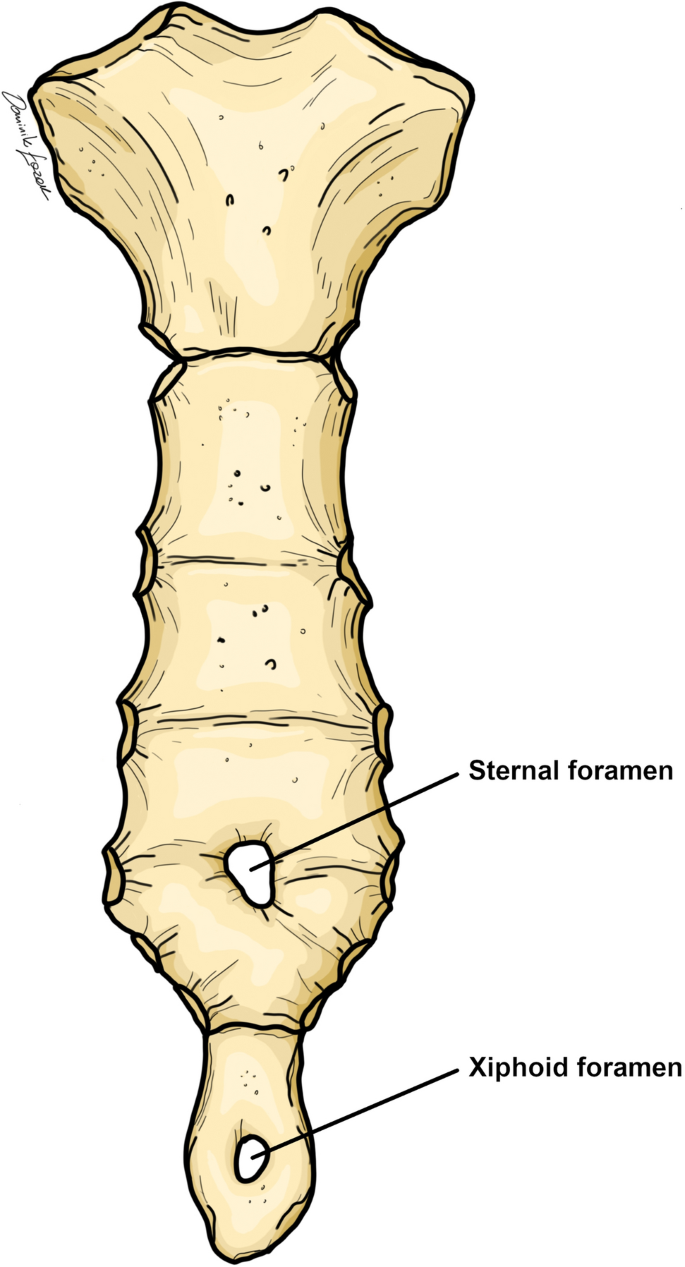 Prevalence and morphometry of sternal and xiphoid foramen: a meta ...