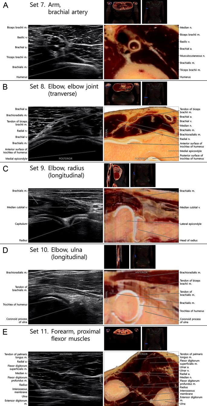 Ultrasonographic images and correspondence with real color sectioned ...