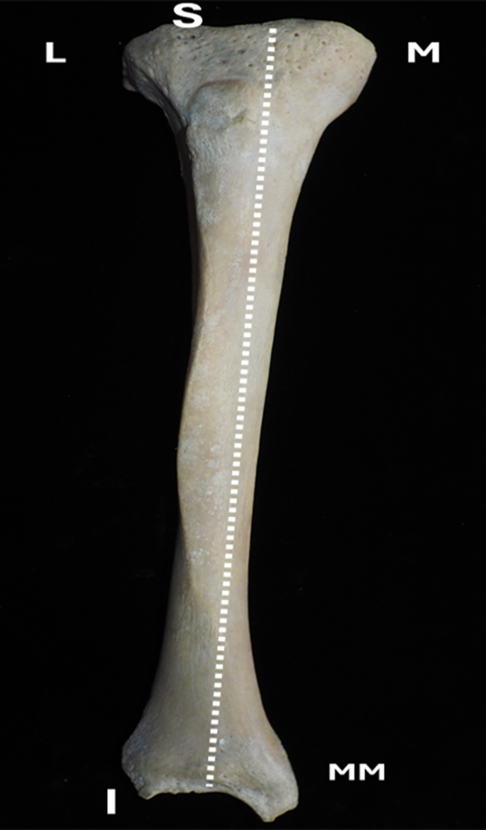 Exploring consistent ratios in morphometry of the proximal tibia ...
