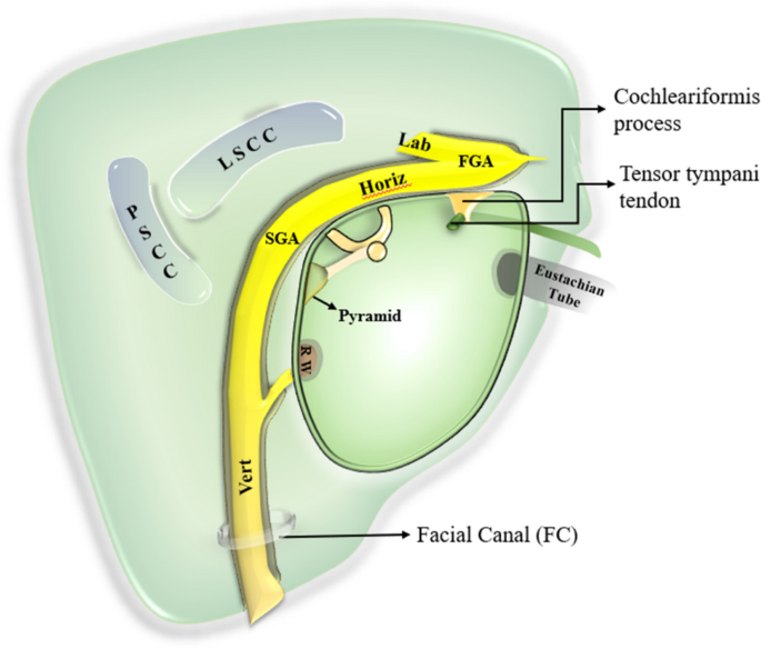 An evaluation of morphometry and dehiscence of facial canal: a ...