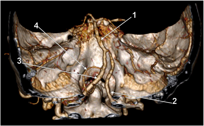 Transverse and oblique course of the vertebral artery over the ...