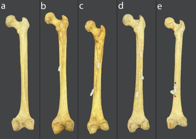 Morphometric, morphologic and topographic evaluation of diaphyseal ...
