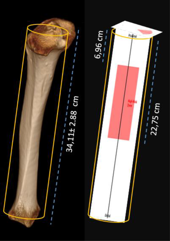 A comprehensive CT analysis of tibial nutrient artery anatomy ...