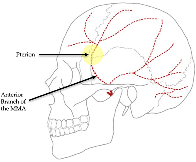 Surgical anatomy of the pterion and its relationship to the middle ...
