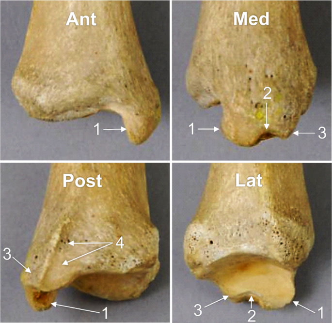 Anatomy and metrics of the medial malleolus | Surgical and Radiologic ...