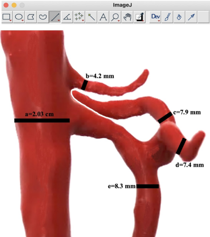 Young anatomists perceptions of aorta-celiac trunk models and their use ...