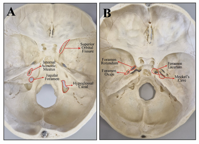Skull base foramina provide a route for the exit of brain lymphatic ...