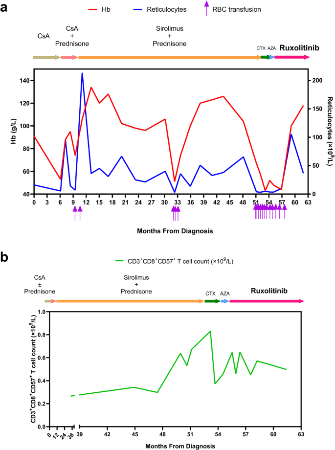 Refractory pure red cell aplasia associated with T-cell large granular ...