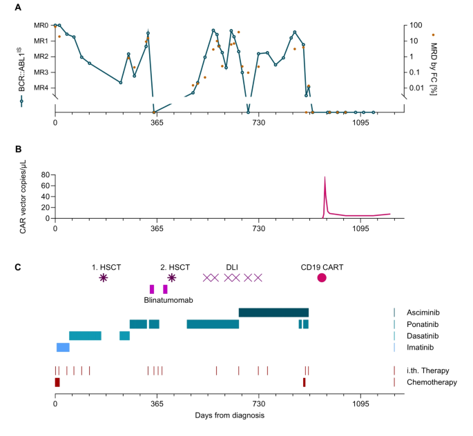 CAR-T cells for the treatment of pediatric chronic myeloid leukemia in ...