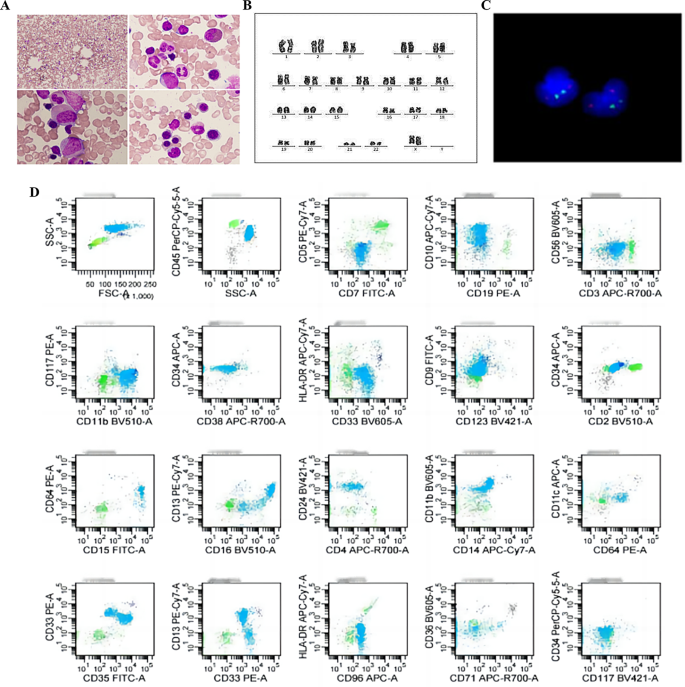 Zebrafish modeling of atypical PML-RARA isoform from acute ...