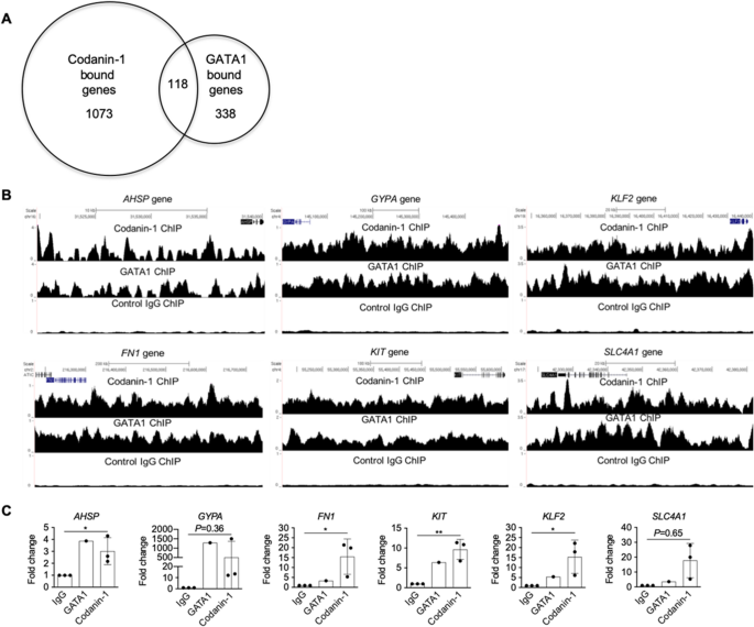 Codanin-1, defective in congenital dyserythropoietic anemia I (CDA-I ...