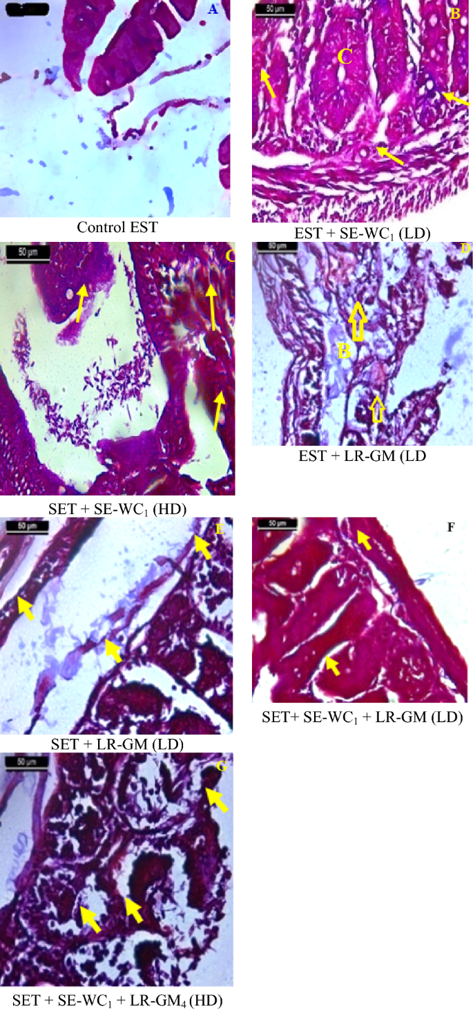 Therapeutic Role of Secondary Metabolites from Probiotic Strains for ...
