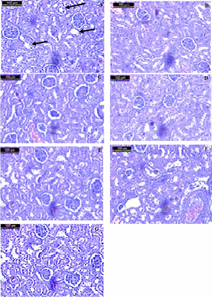 Therapeutic Role of Secondary Metabolites from Probiotic Strains for ...