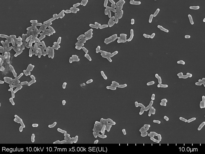 Agromyces aerolatus sp. nov., an Actinobacterium Isolated from Air of ...