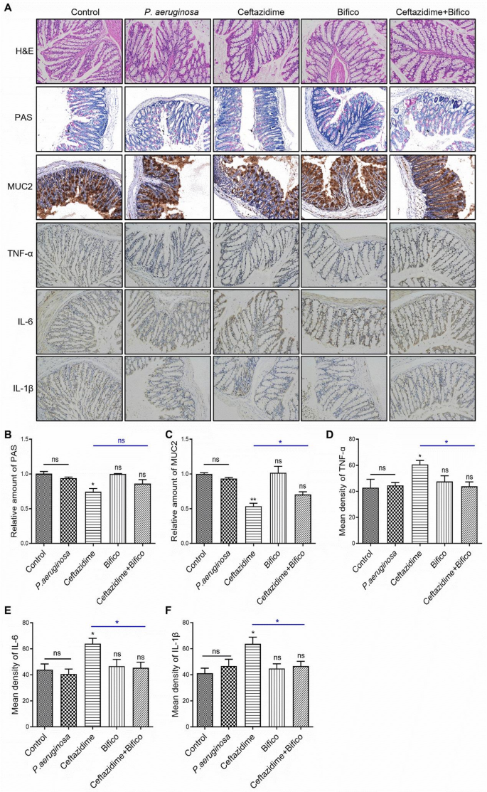 Ceftazidime Combined with Bifico Improves Therapeutic Efficacy and ...