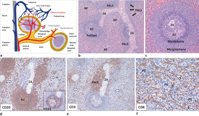 Pathologie der Milz | Die Pathologie | Springer Nature Link