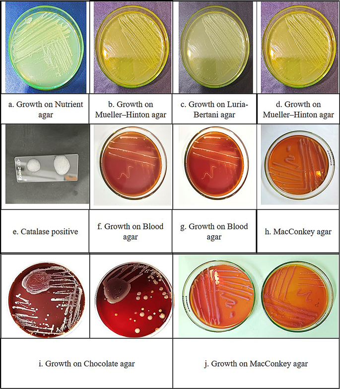 Whole-genome evaluation and prophages characterization associated with ...