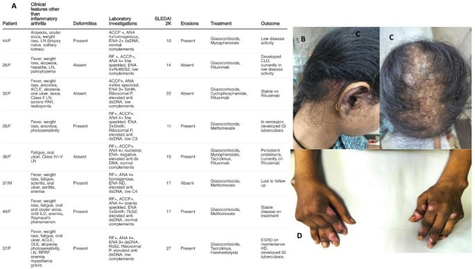 Clinical spectrum of rhupus syndrome: a series of eight cases ...