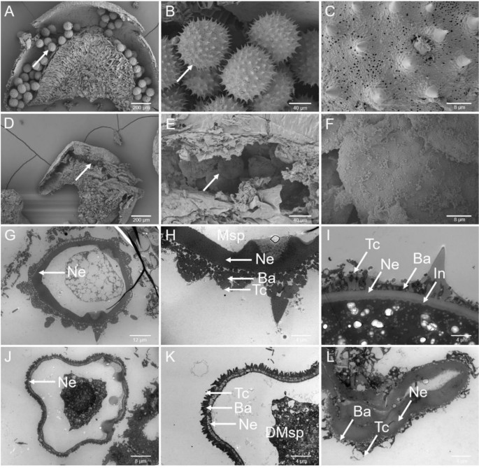 Key genes and molecular mechanisms responsible for male sterility ...
