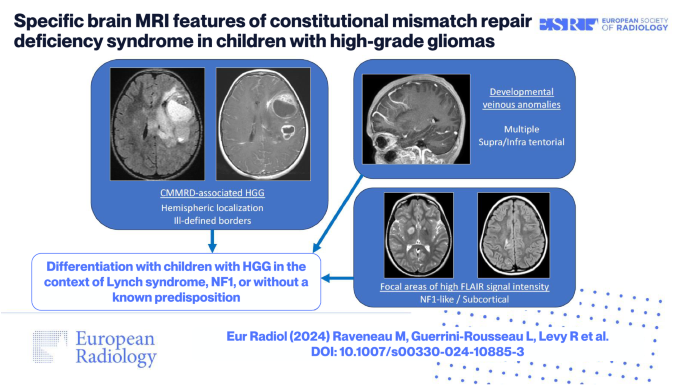 Specific brain MRI features of constitutional mismatch repair ...