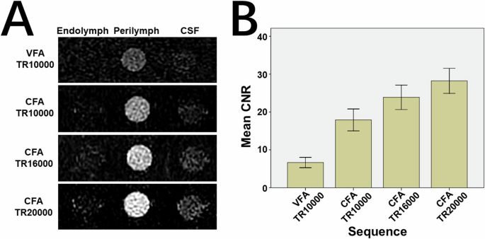 An unenhanced 3D-FLAIR sequence using long repetition time and constant ...