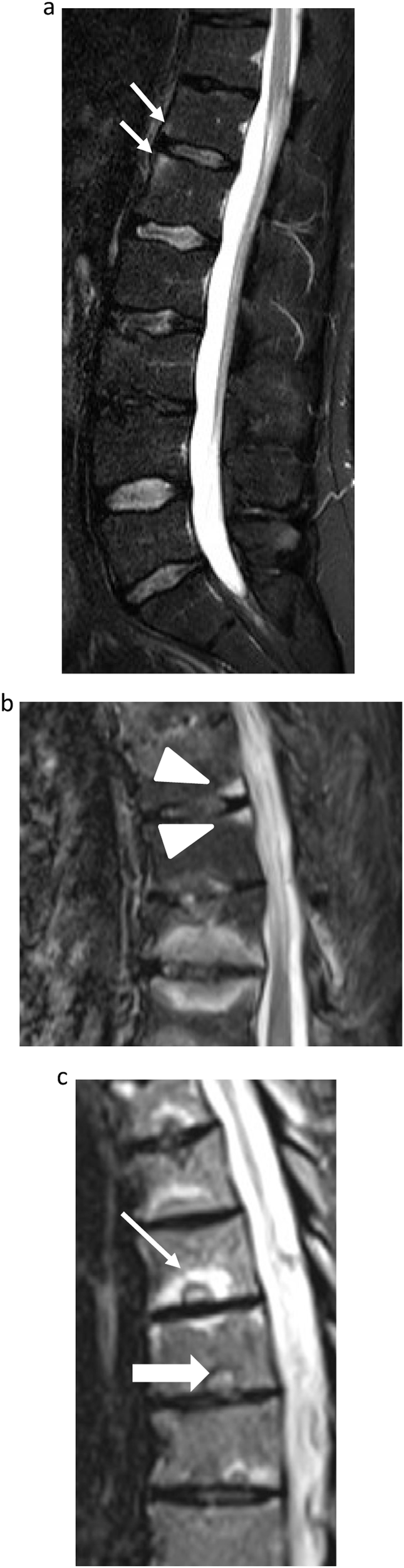 Standardized reporting of spine and sacroiliac joints in axial ...
