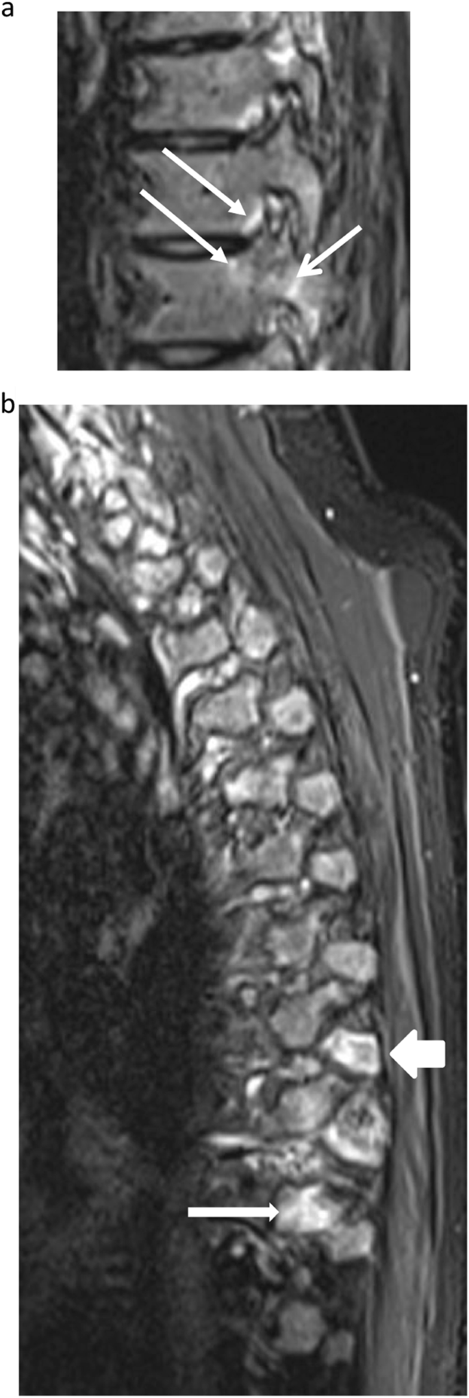 Standardized reporting of spine and sacroiliac joints in axial ...