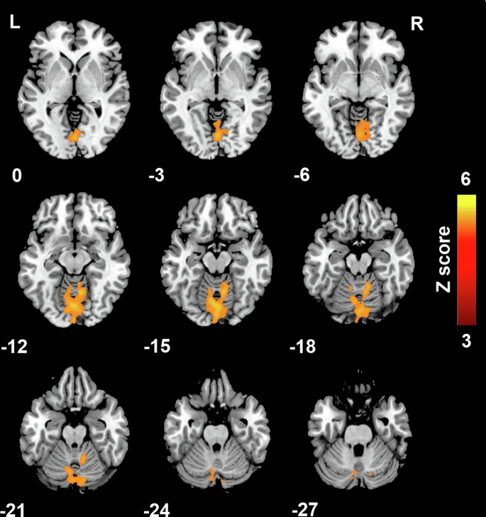 Structure-function interrelationships and associated neurotransmitter ...