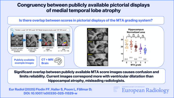 Congruency between publicly available pictorial displays of medial temporal lobe atrophy ...