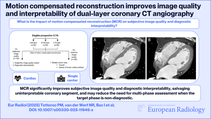 Motion compensated reconstruction improves image quality and interpretability of dual-layer ...