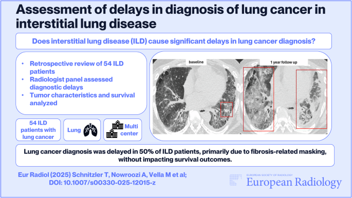 Assessment of delays in diagnosis of lung cancer in interstitial lung ...