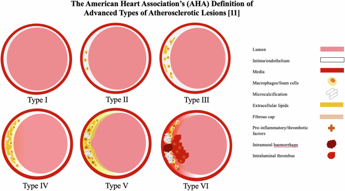 Assessment of carotid atherosclerotic plaque vulnerability with multi ...