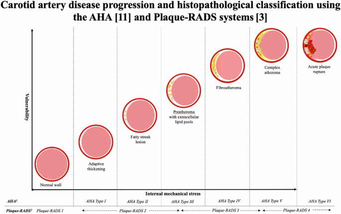 Assessment of carotid atherosclerotic plaque vulnerability with multi ...