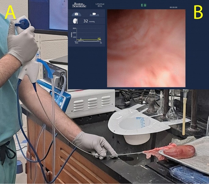 Intrarenal pressure and flow rate profile using LithoVue™ elite: impact ...