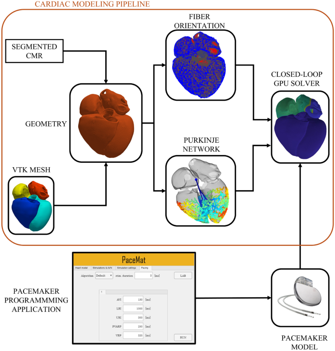 A Matlab platform for pacemaker algorithm assessment based on ...